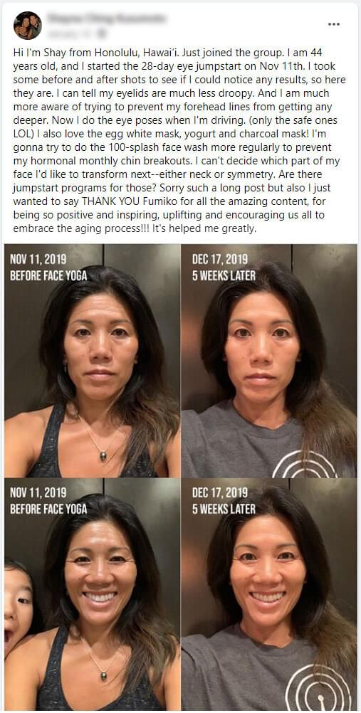 How Face Yoga Is Revolutionizing The Beauty Industry